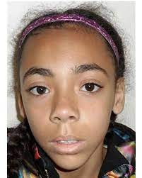 Treasure Anderson - Missing Persons Center